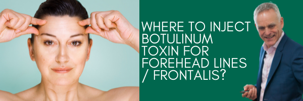 Botulinum Toxin for Forehead Lines / Frontalis | Video