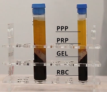 Cellenis PRP - Choosing the Best Platelet Rich Plasma Technology